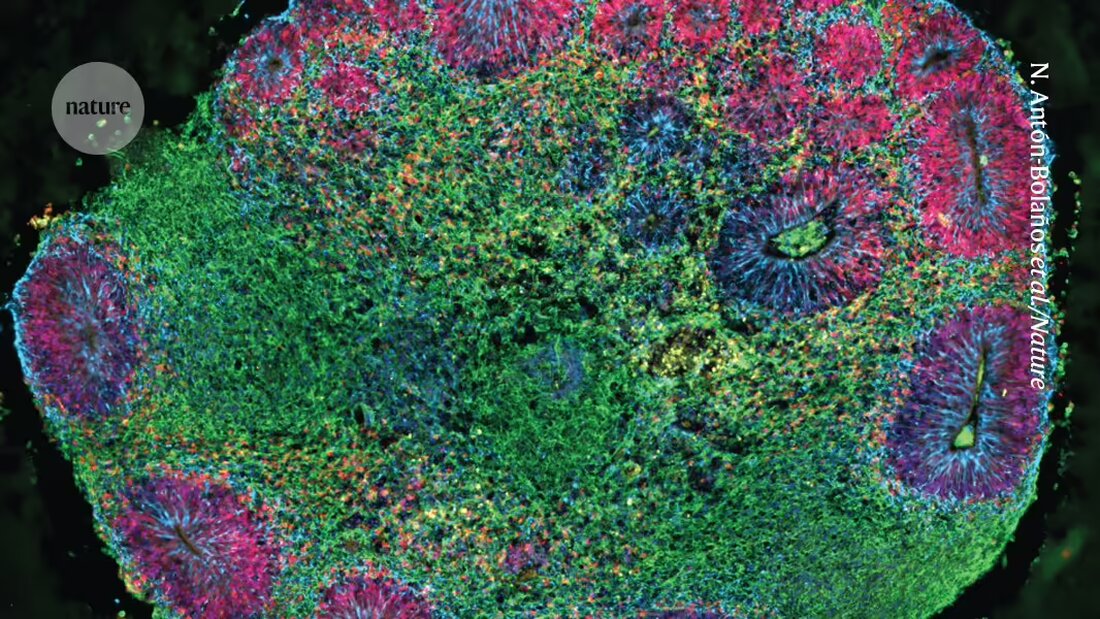 Rewolucyjny model mózgu 3D z komórkami wielu osób